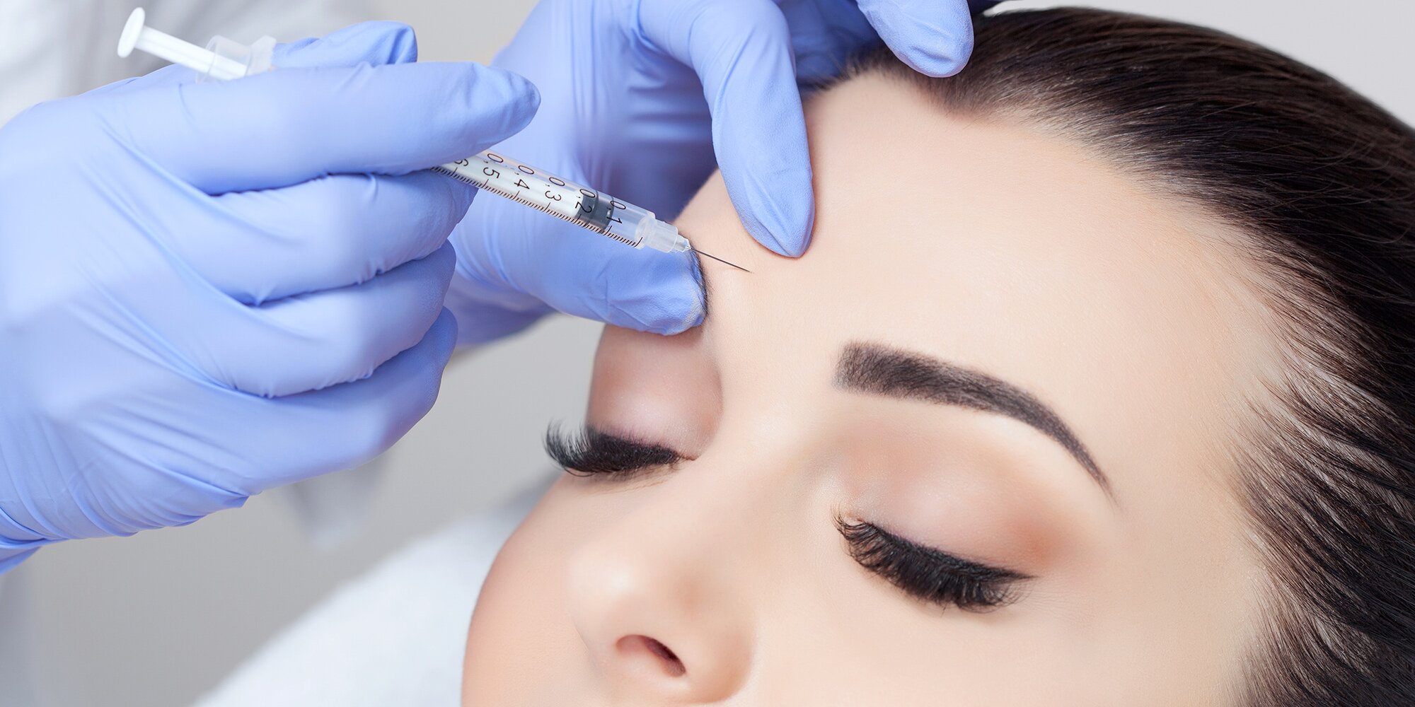 Botox pro vyhlazení vrásek na čele i okolo očí | Slevomat.cz